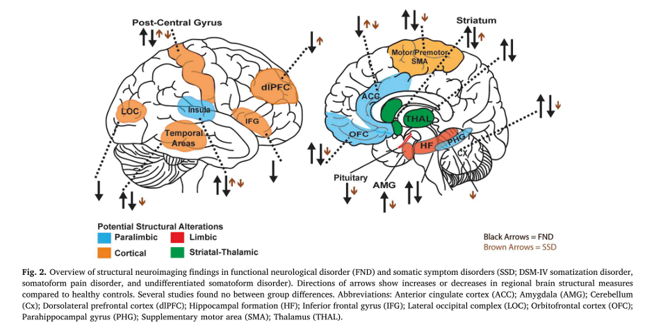 Can people with FND have changes to the structure of their brain too ...